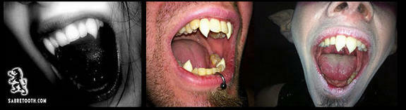 Vampire Fang Styles | Coast to Coast AM