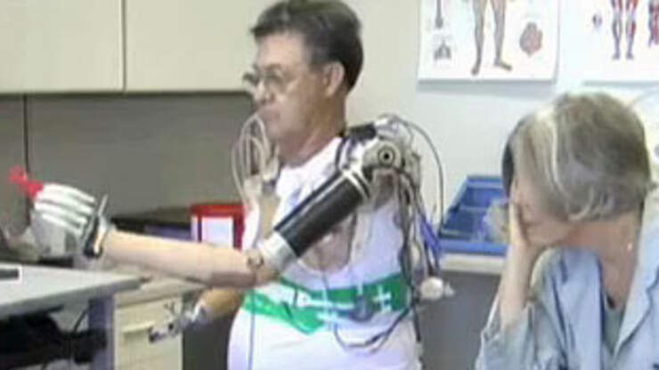 Mind-Controlled Bionic Arm | Coast to Coast AM