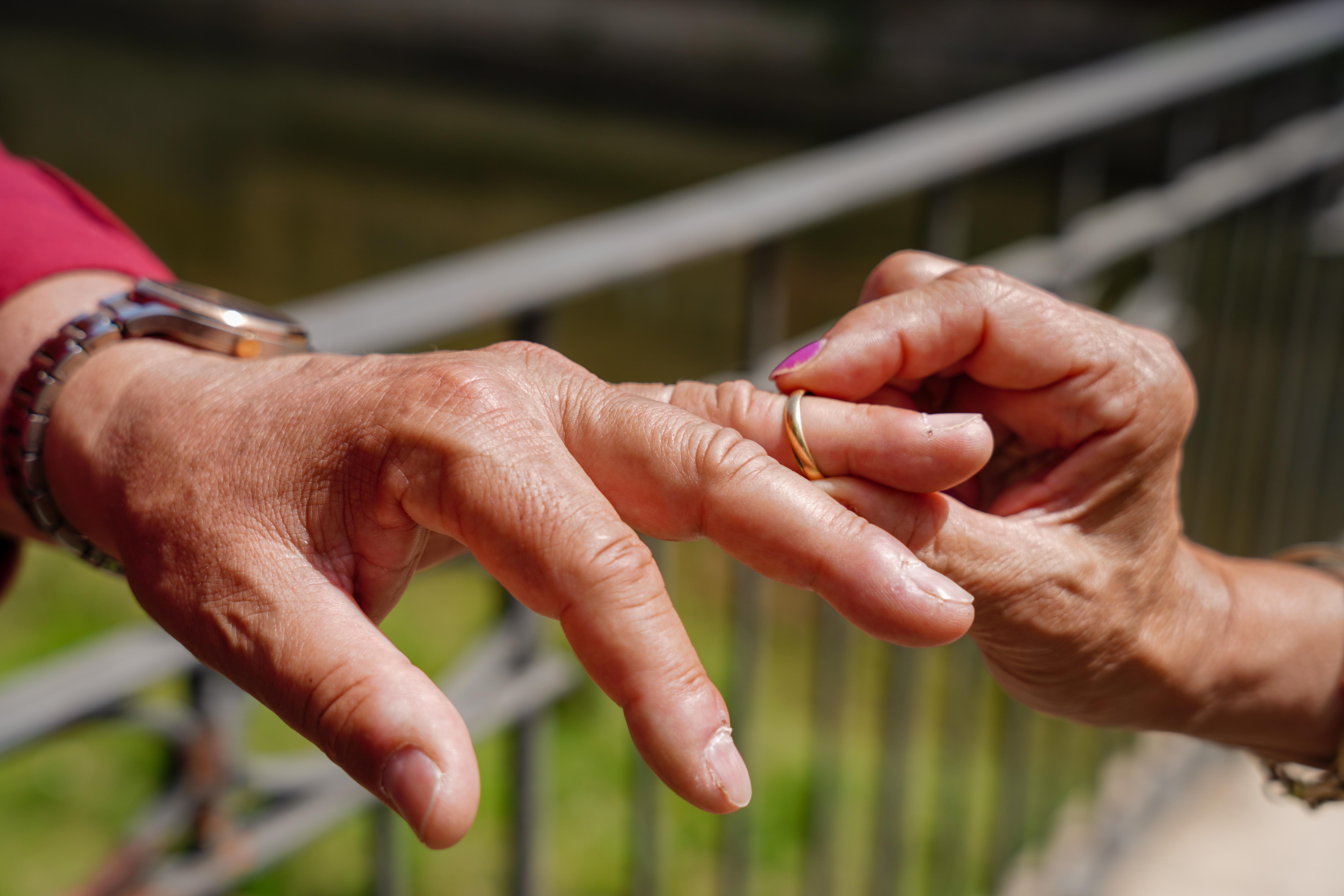 Nurse Aid Accused Of Stealing Rings From Elderly Patients Hands | iHeart