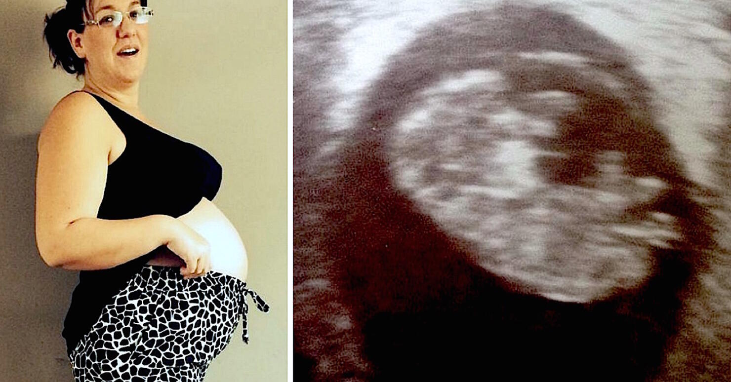 Mom Had Heartburn For Days Before Learning Womb Exploded With Baby ...