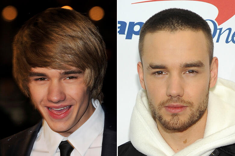 17 Celebs With And Without Beards | iHeartRadio