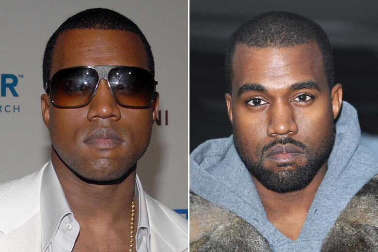 17 Celebs With And Without Beards | iHeartRadio