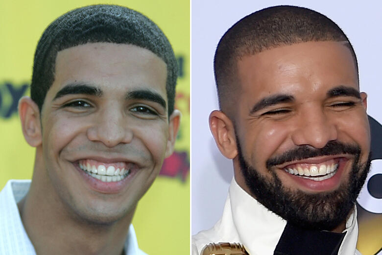 17 Celebs With And Without Beards | iHeartRadio