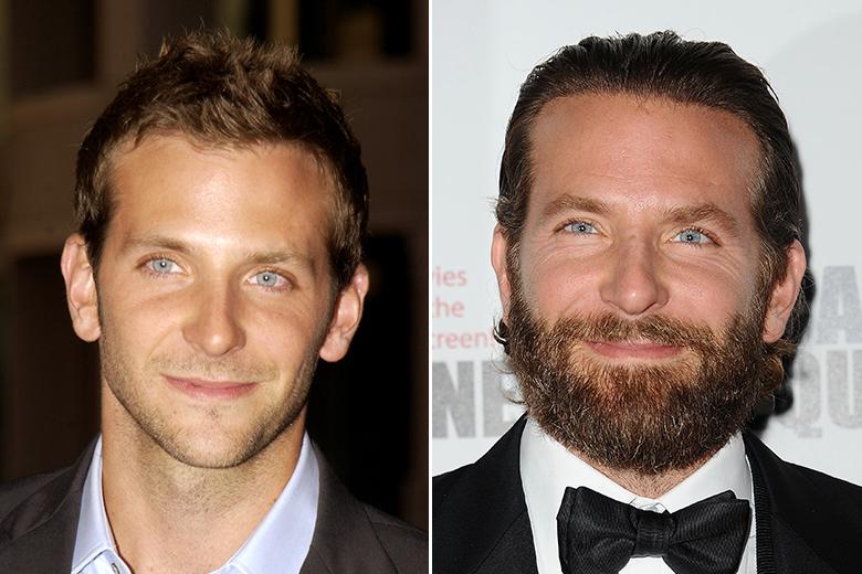 17 Celebs With And Without Beards | iHeartRadio