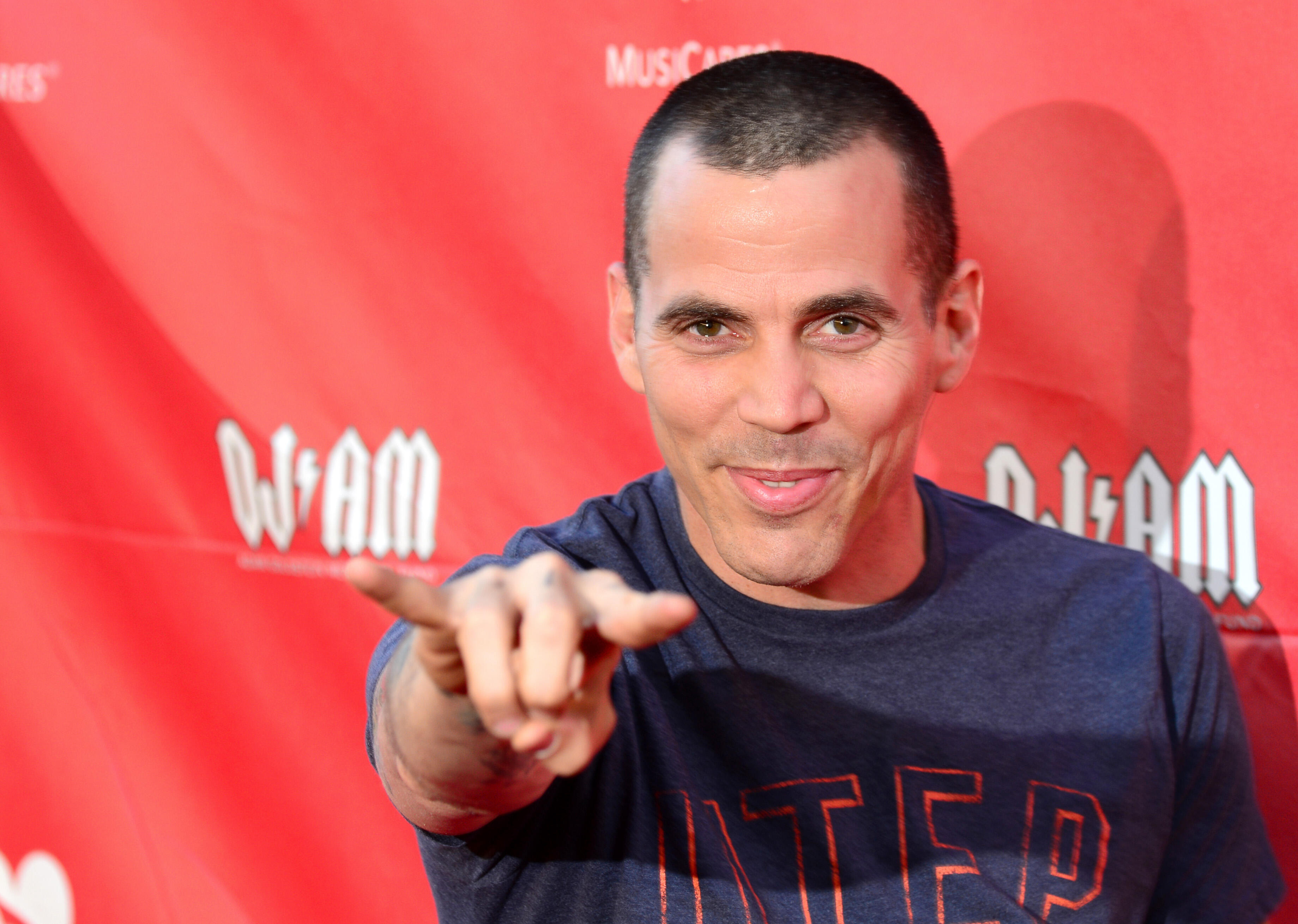 Steve-O Shares The Top 10 Worst Injuries Of His Wild Career | iHeart