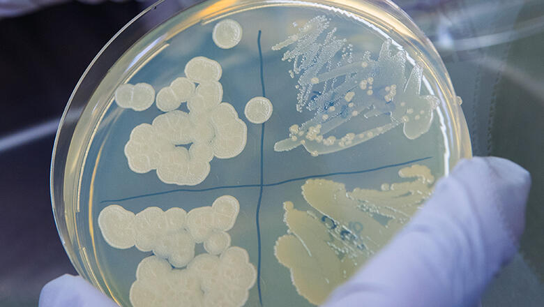 E. Coli Outbreak Leaves People Sick Across Five States | iHeart
