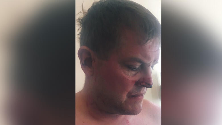 American Charged With Manslaughter In Caribbean Thought Victim Was ...