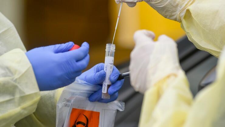 FDA Authorizes First At-Home Coronavirus Sample Collection Kit ...