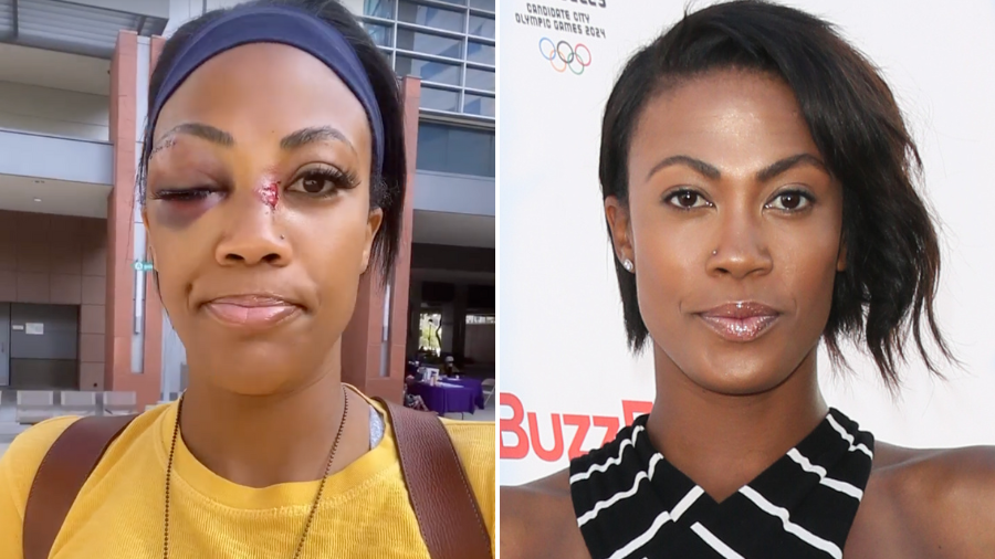 Olympian Kim Glass Nearly Blinded After Being Attacked With A Metal ...