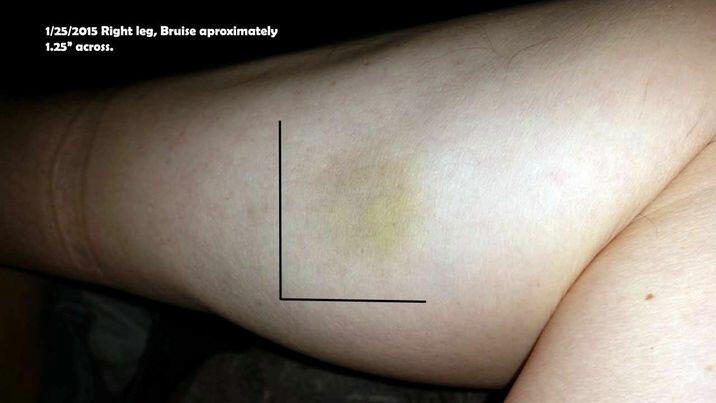 Byron Lacy 'Alien' Markings Photos | Coast to Coast AM